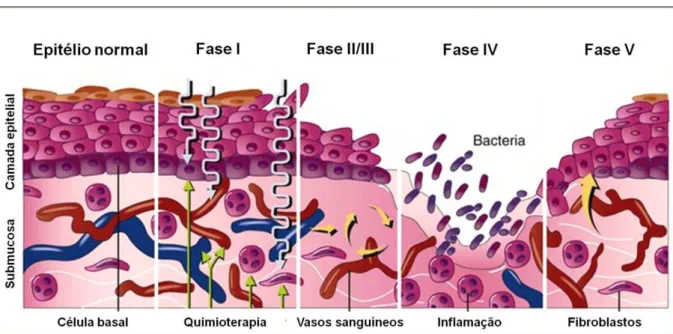 Fisiopatologia da mucosite intestinal por irinotecano