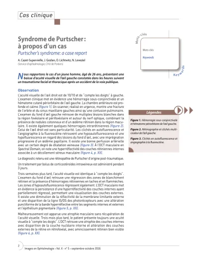 Syndrome de Purtscher : à propos d'un cas