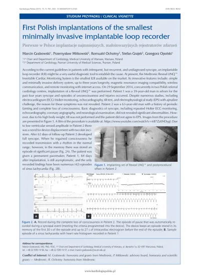 First Polish implantations of the smallest minimally invasive ...